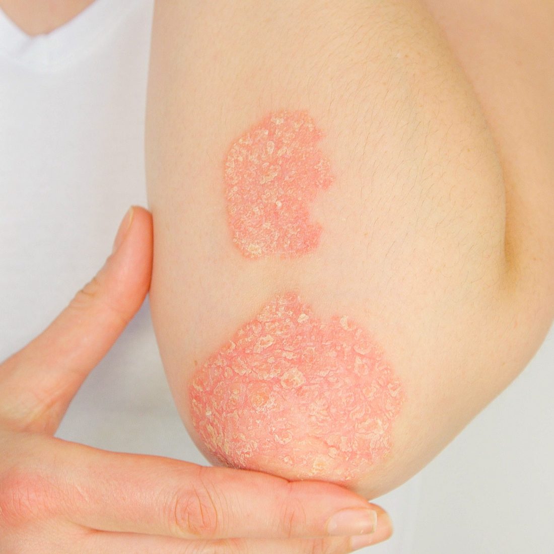 Hautarzt Dr. Patrick Kropp